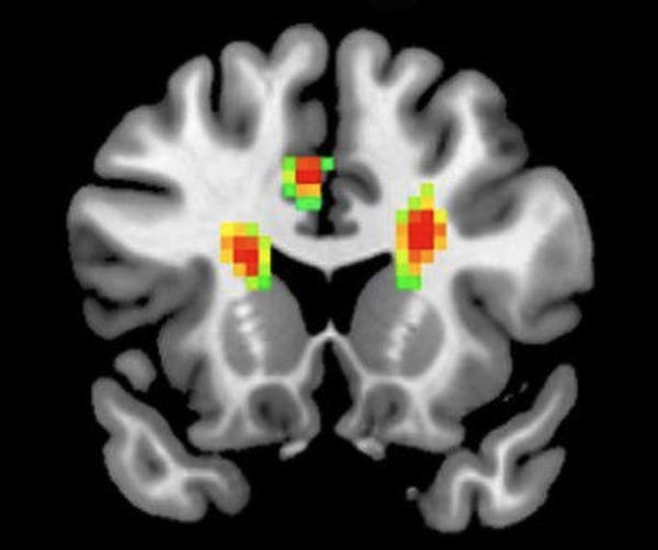This Is What Actually Happens To Your Brain When You Fall In Love