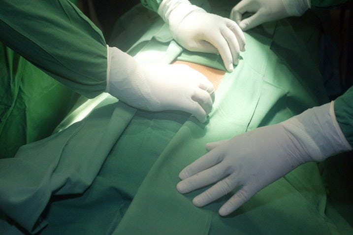 Scientists Now Say The Appendix Isn't Useless